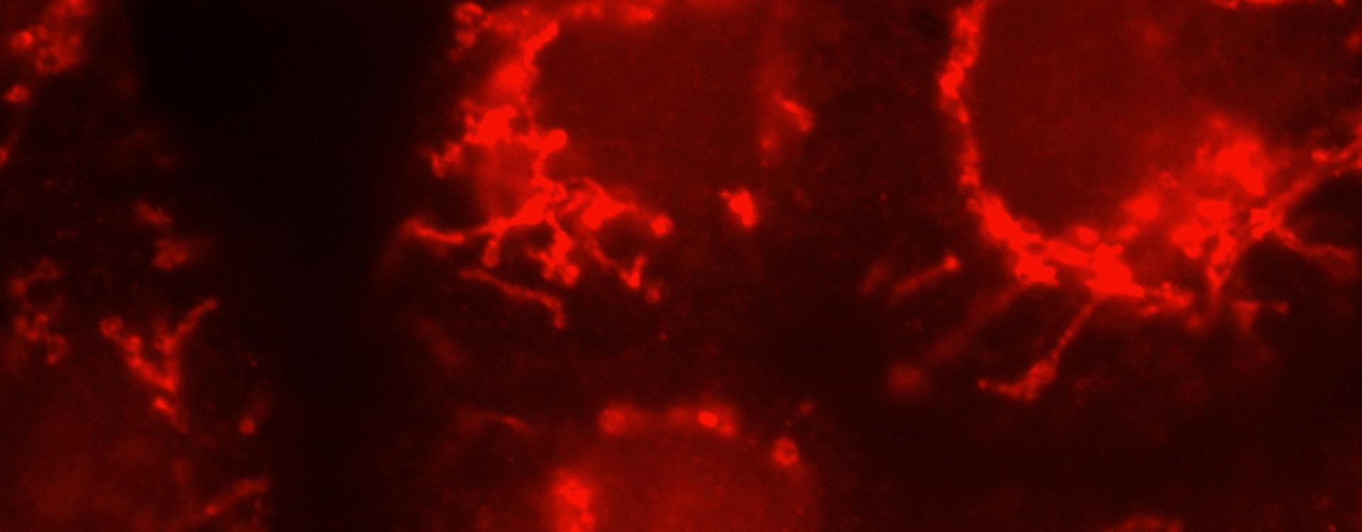 Máster en Biomedicina Molecular | Facultad de Medicina | UAM